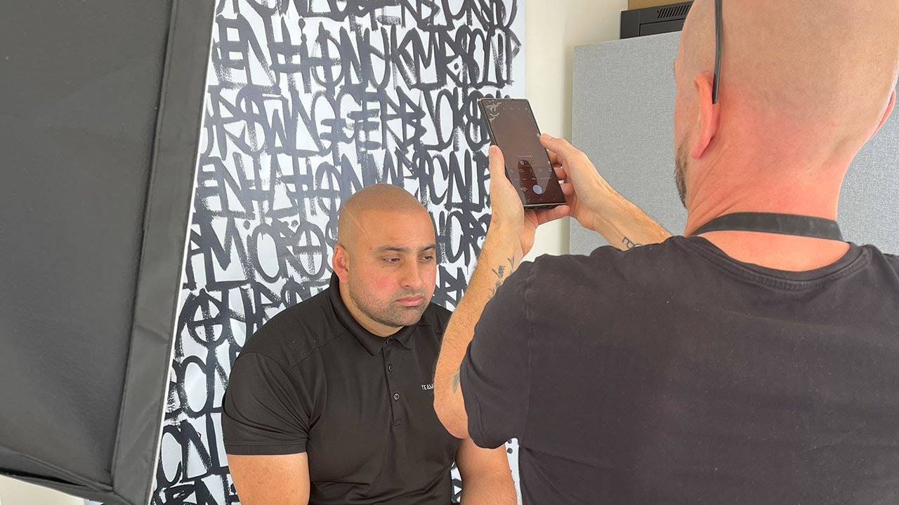 Botched To SMP Badass@ Naz' Scalp Micropigmentation Story - YouTube