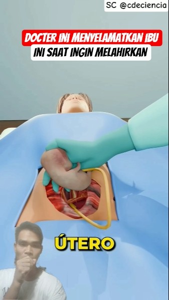docter ini menyelamatkan sang bayi dan ibu nya #doctor #treding #funny ...