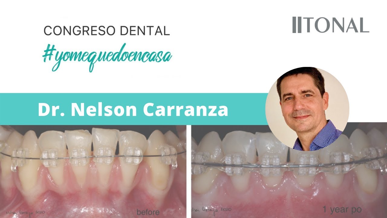 Nelson Carranza sobre la técnica LAST #yomequedoencasa | TONAL ...
