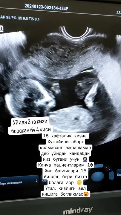 беременность узи Youtube