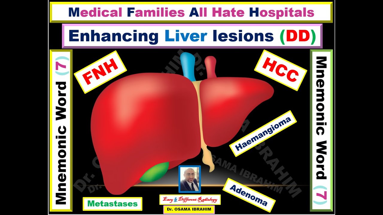 DD of enhancing liver lesions (Mnemonic word 7), {Medical Families All ...