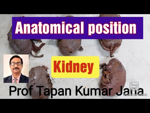 Kidney - 1 l Anatomical position l Anatomical features l Presenting ...