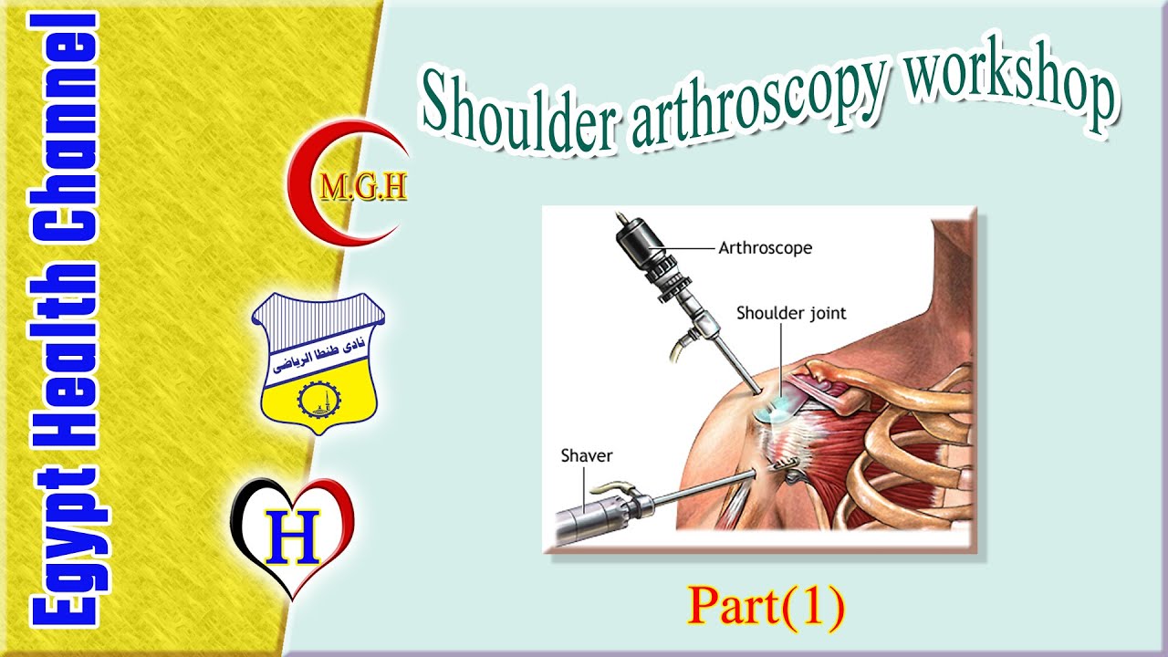 Shoulder arthroscopy workshop - Part 01 - YouTube