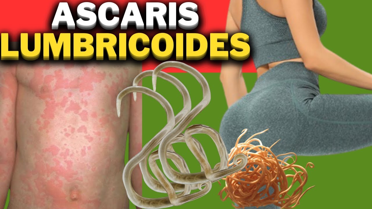 (LOMBRIGAS) Ascaris lumbricoides: Segredos, Riscos e Soluções para uma ...