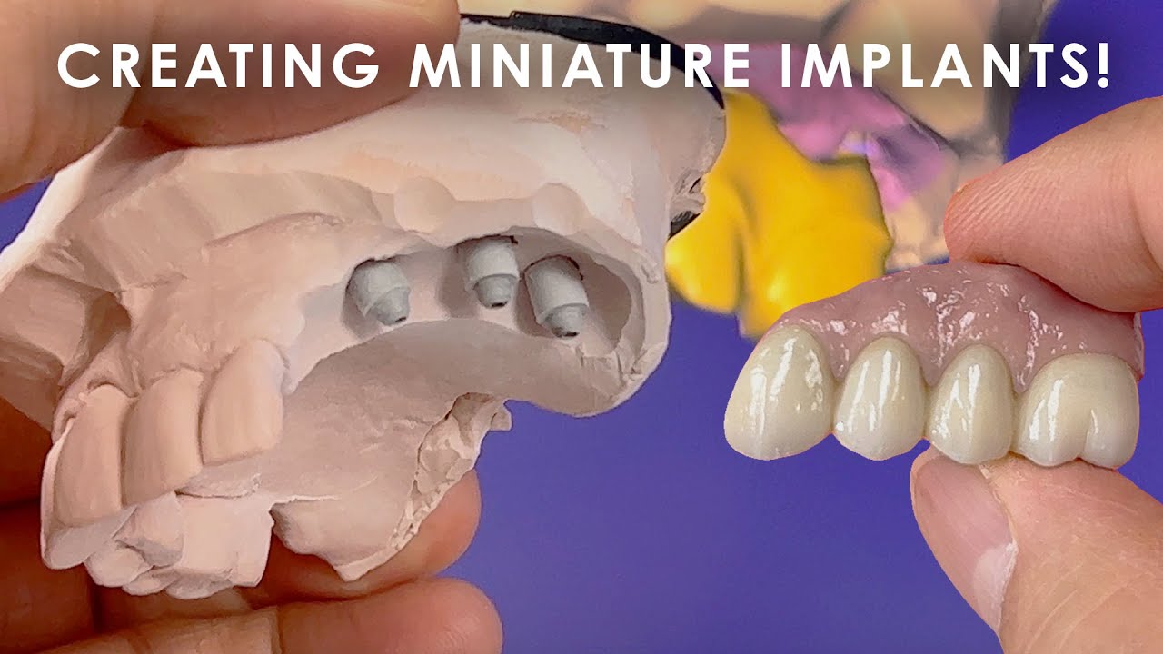 Creating Miniature Full Mouth Implants - YouTube