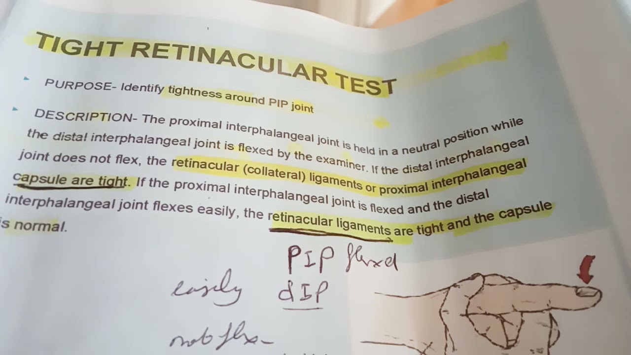 Tight retinacular test - YouTube