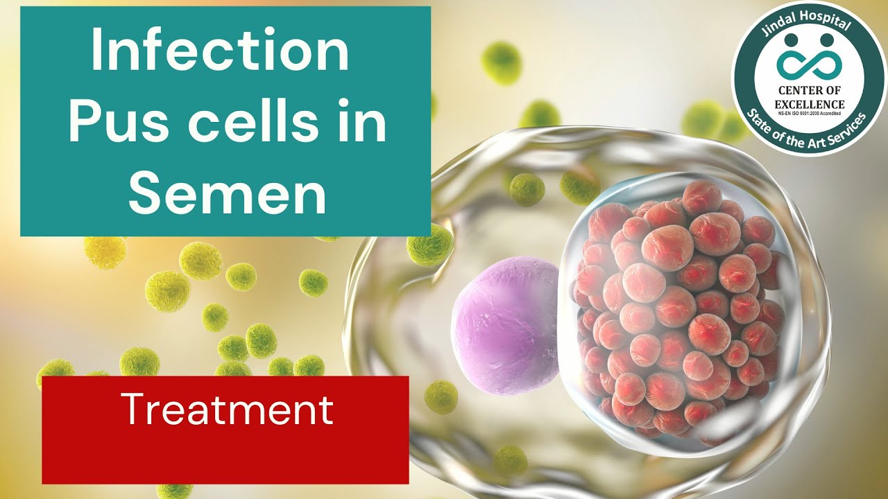 Infection in semen - YouTube