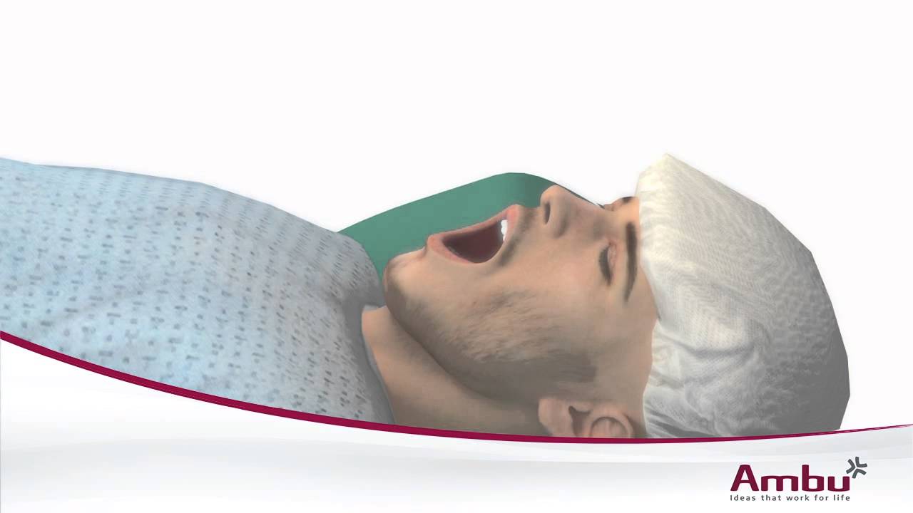 Ambu® aScope™ 3 and Ambu® Aura-i 3D animation - YouTube