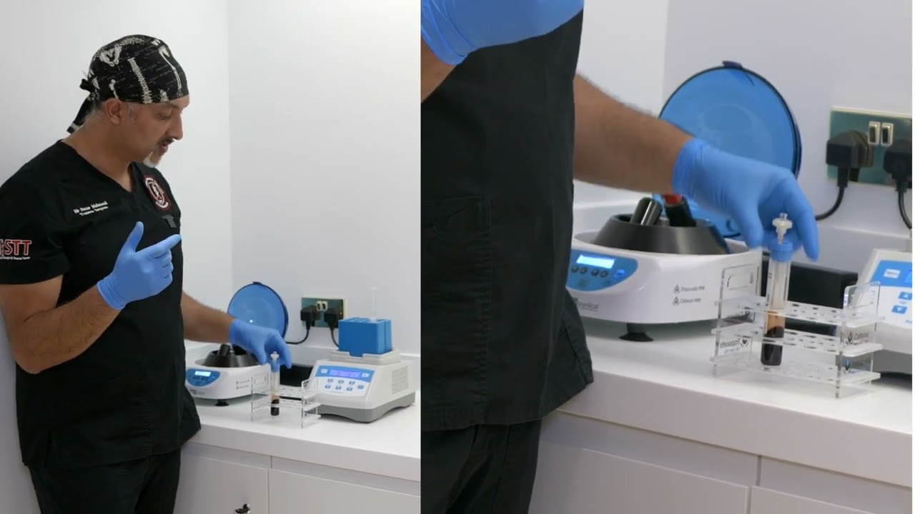 Market leading properties of Cellenis and Tropocells PRP systems - YouTube