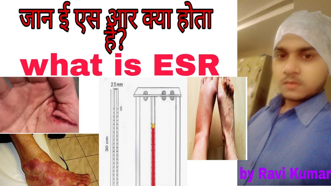 WHAT IS ESR ( BASIC DETAILS ) - YouTube