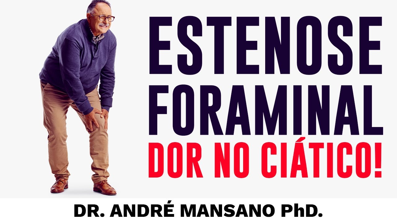 Estenose Foraminal Neural Lombar Hérnia De Disco Foraminal E Seu