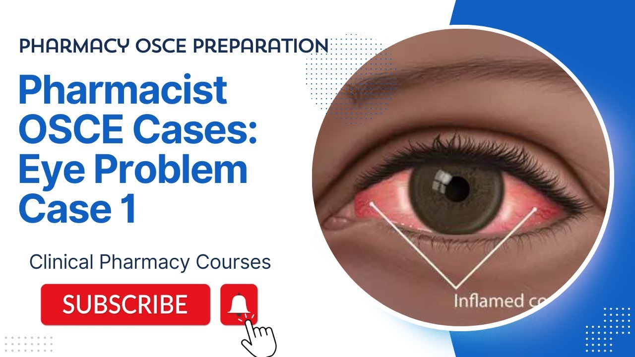 Pharmacy OSCE Preparation: Eye Case 1 | PEBC | OSCE Cases - YouTube