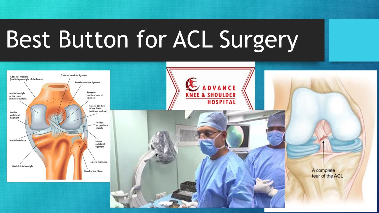 Best button for ACL surgery - YouTube