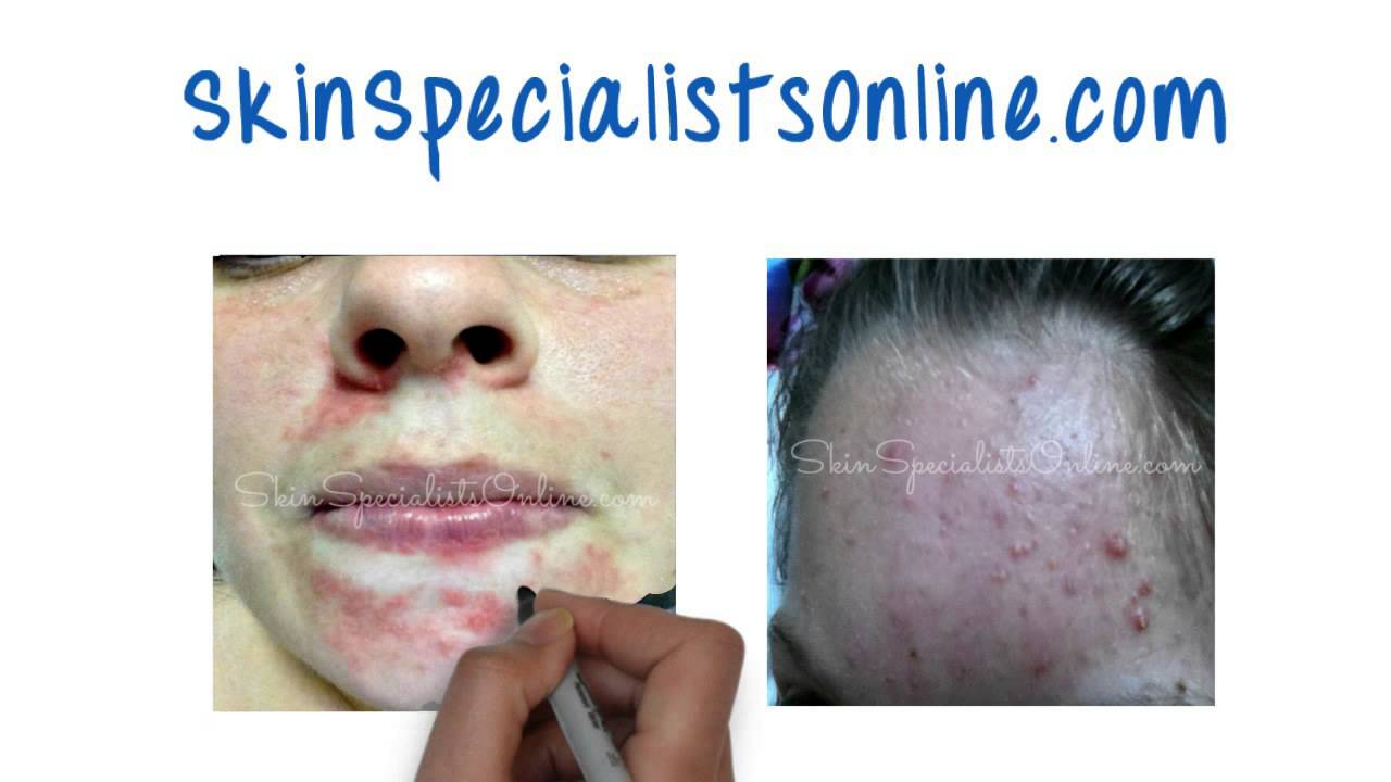 Ask Skin Doctor for Free - YouTube
