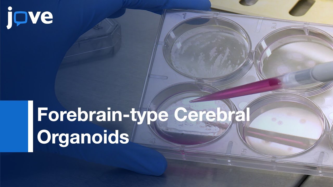 Forebrain-type Cerebral Organoids Generated from hiPSCs | Protocol ...