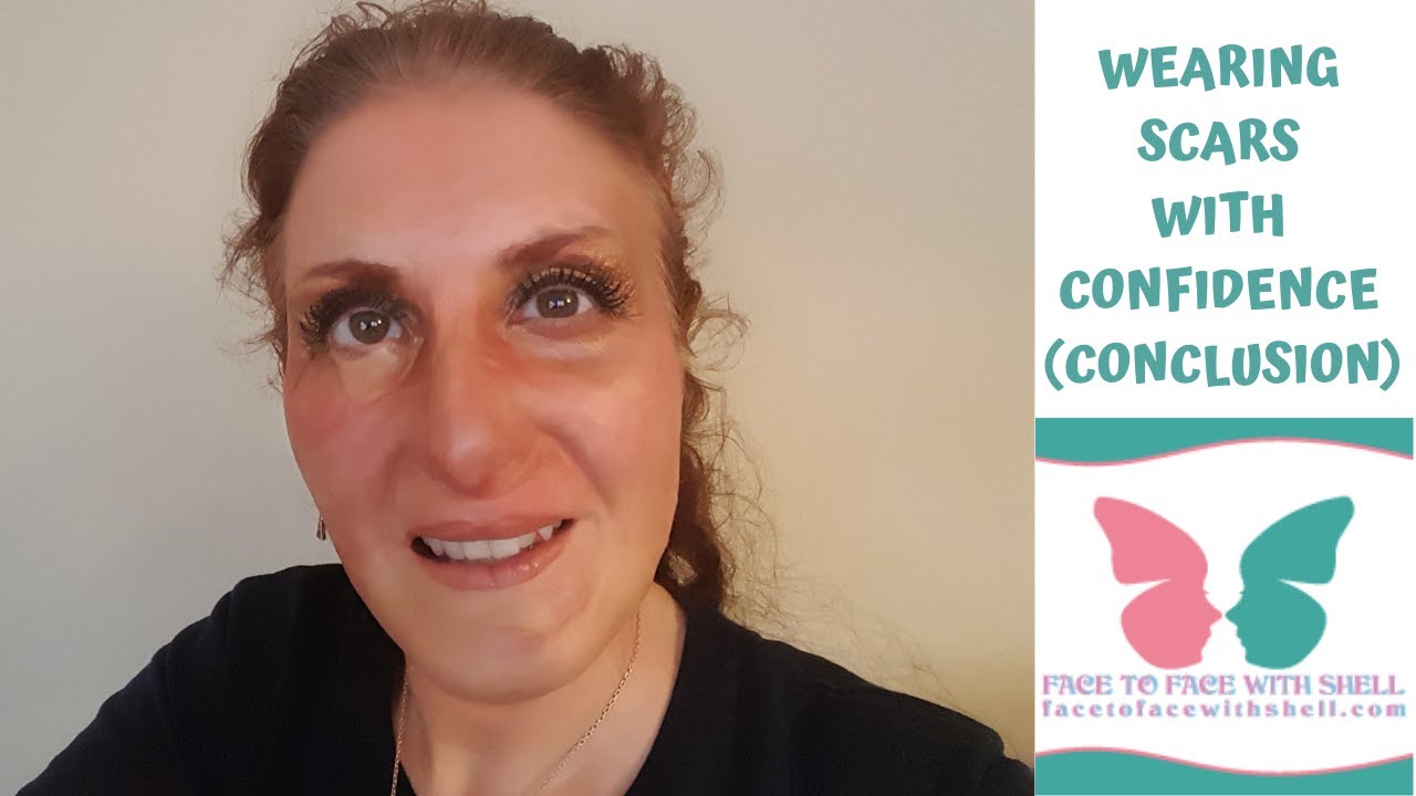 WEARING SCARS WITH CONFIDENCE (CONCLUSION) - YouTube