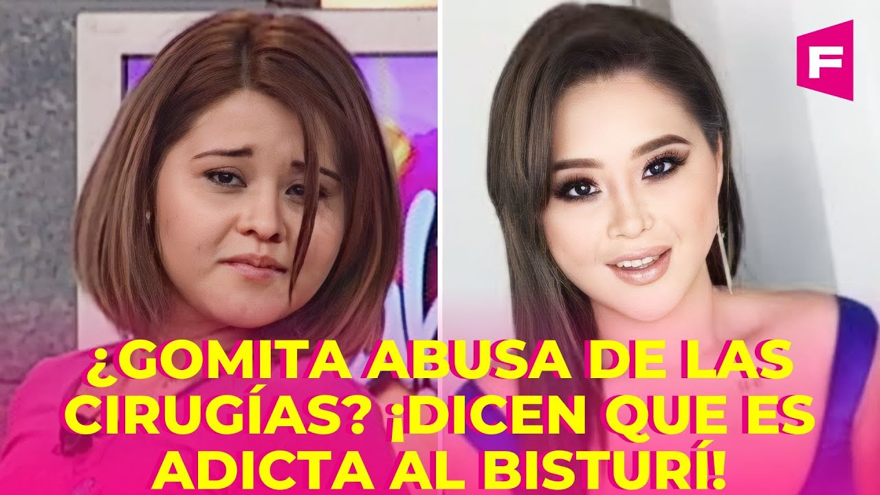 GOMITA se hará una nueva cirugía y sus fans le piden que ya se detenga ...