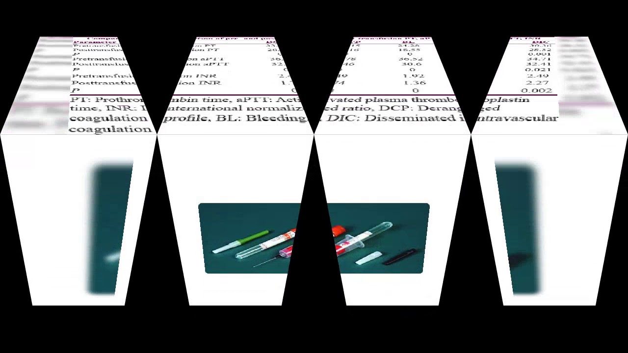 Vacuum Sample collection procegers - YouTube