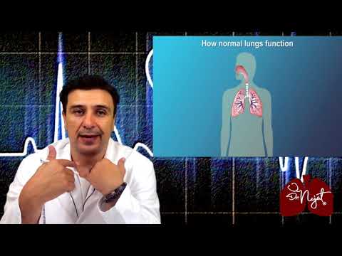 What is COPD?     Nejat Altintas M.D.,