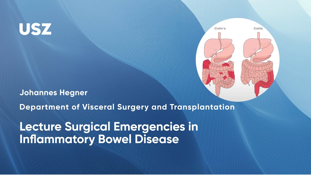 Lecture Surgical Emergencies in Inflammatory Bowel Disease - YouTube