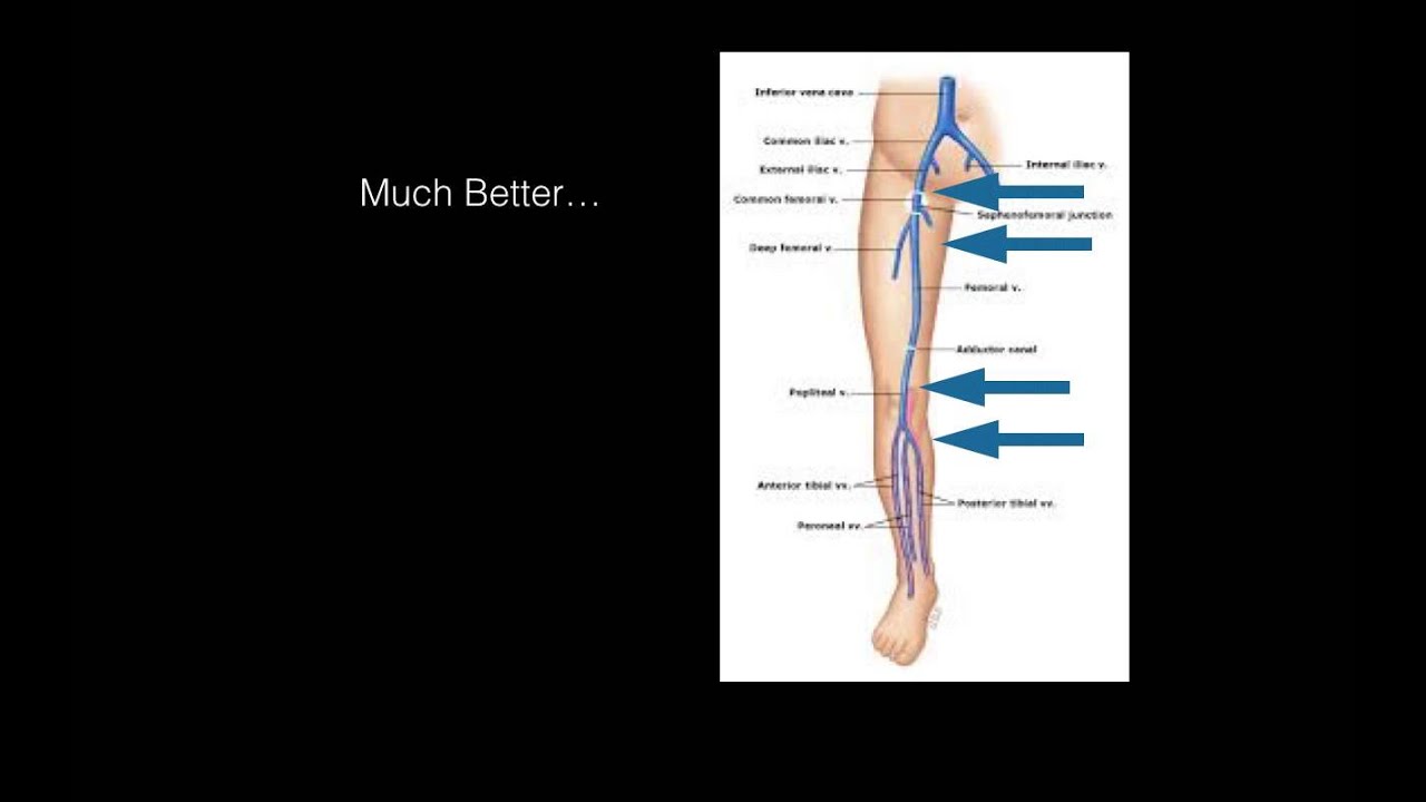 DVT US Pres Final - YouTube