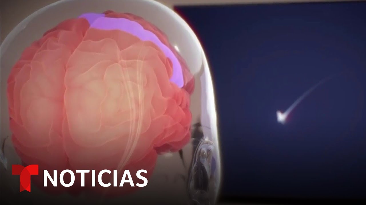 Implantan con éxito el primer chip cerebral en un ser humano | Noticias ...