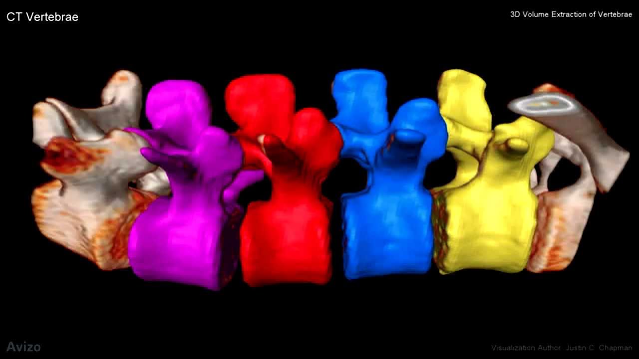 Spinal Vertebrae Visualization / Segmentation - YouTube