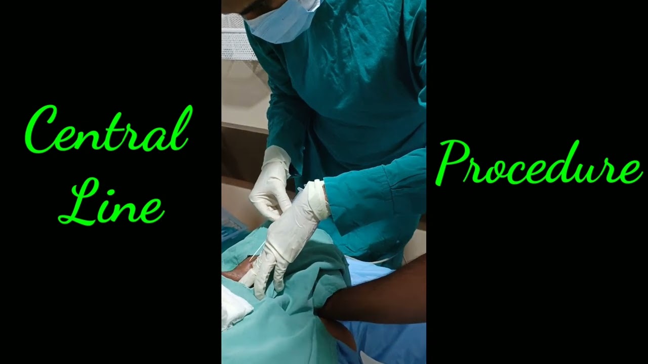Central line Procedure! Central line कैसे कि जाती है?Central venous ...