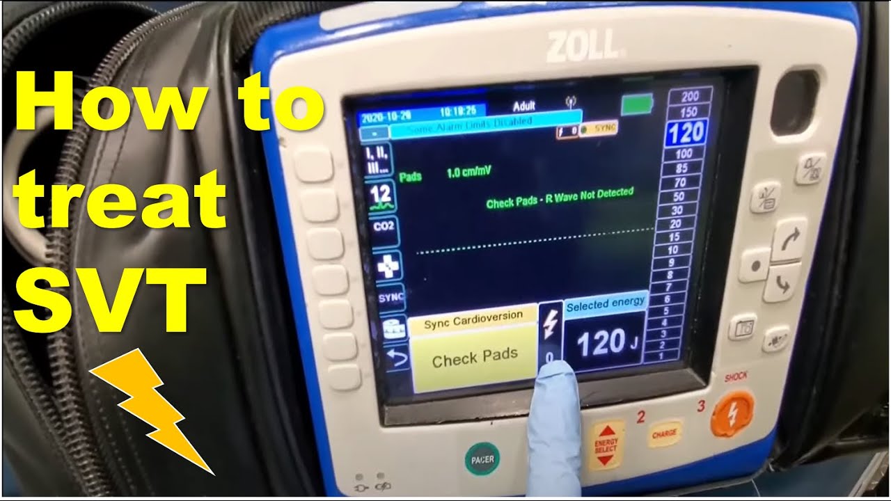 How To Treat SV Tachycardia | NYC Ambulance 🚑 | NYC EMT Paramedic ...