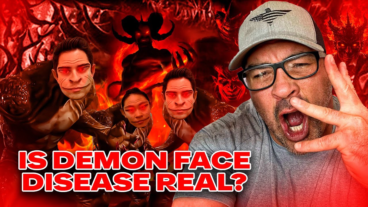 REAL?! Demon Face Syndrome Revealed..Shapeshifters Among Us? You Will ...