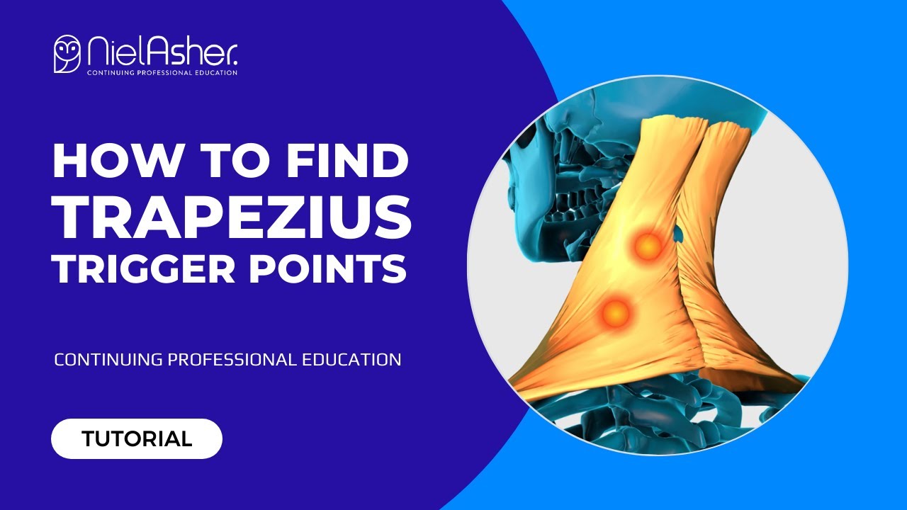 Pinpointing Trigger Points in the Trapezius Muscle: Your Comprehensive ...