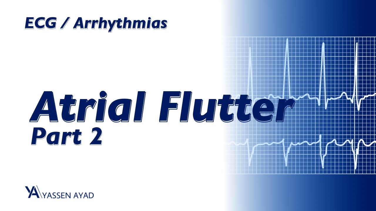 ECG 50 | Atrial Flutter 2 - YouTube