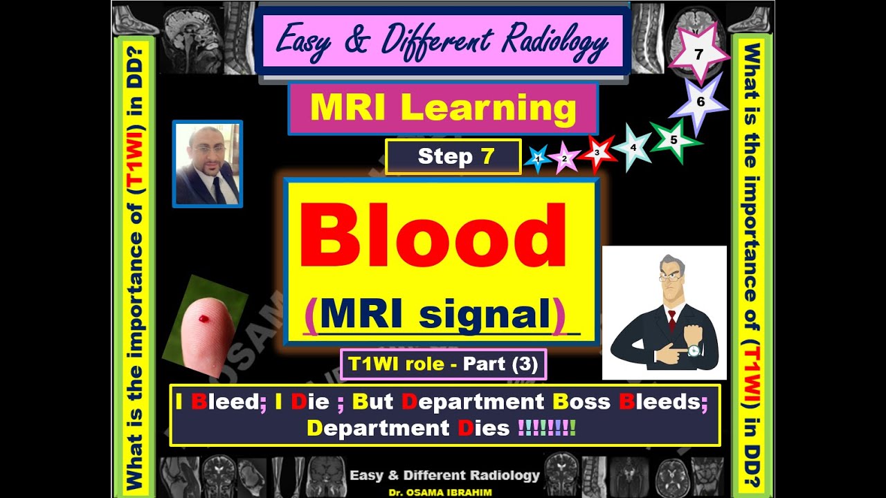 MRI Learning (7) T1WI (part 3); Blood MRI signal - YouTube