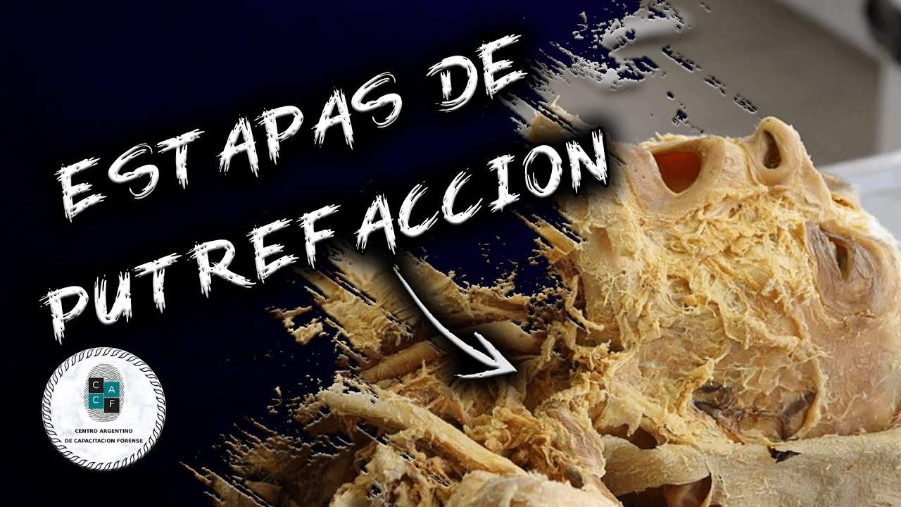 Etapas de Putrefacción - Criminalística para Principiantes - YouTube
