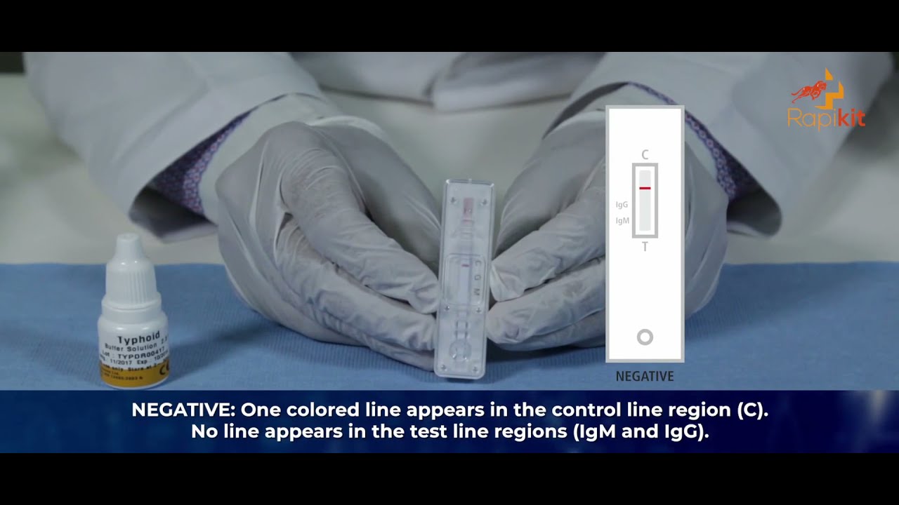 Rapikit Typhoid Rapid Test Instructional Video - YouTube