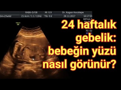 24 haftalık gebelik: ultrasonda bazılarımızın bebeğin yüzü sandığı bölge aslında neresidir?