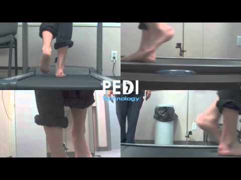 Video Gait Analysis : Foot function Orthotics heel pain Mississauga Brantford Podiatry Chiropody ...