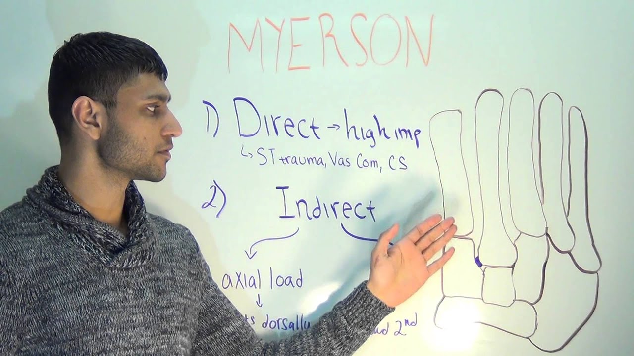 Myerson classification - LisFranc Injuries - YouTube