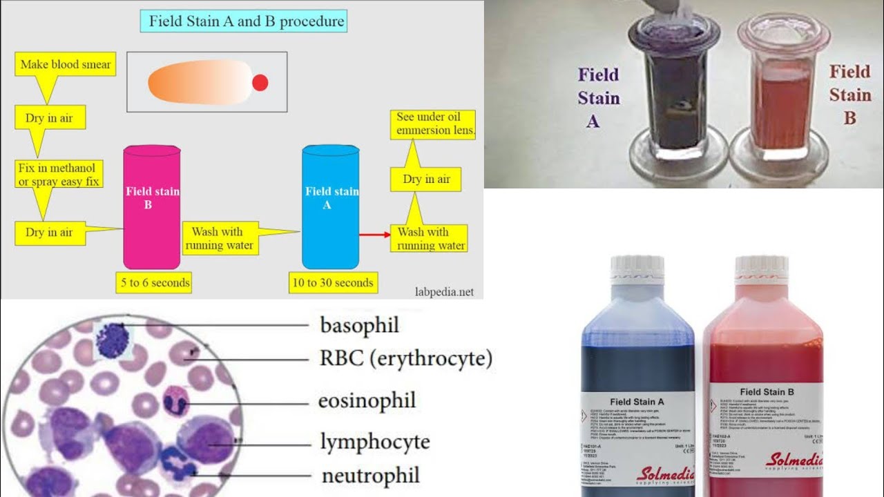 PROCEDURE FOR STAINING THIN FILM SMEAR USING FIELD STAIN A AND B - YouTube
