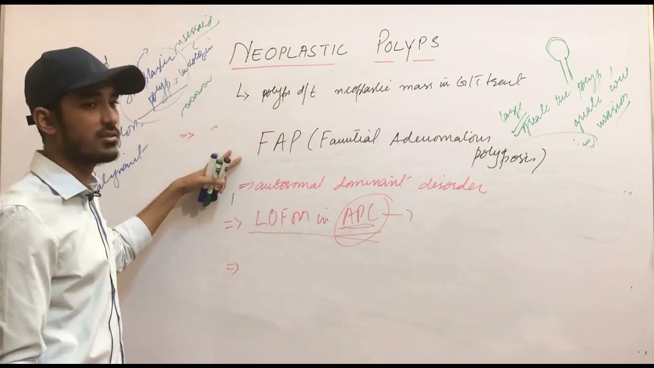 Lecture 16 Part 02- Neoplastic Polyps | Special Pathology @drsaadqureshi6734 - YouTube