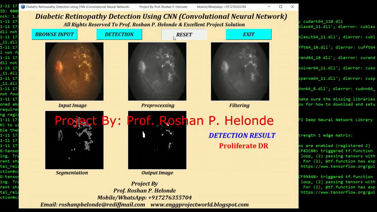 Python Code for Diabetic Retinopathy Detection Using CNN | Python ...