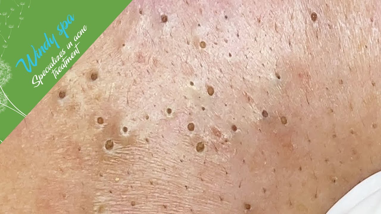 Make Your Day Relaxing with Windy Spa 6#191 - YouTube