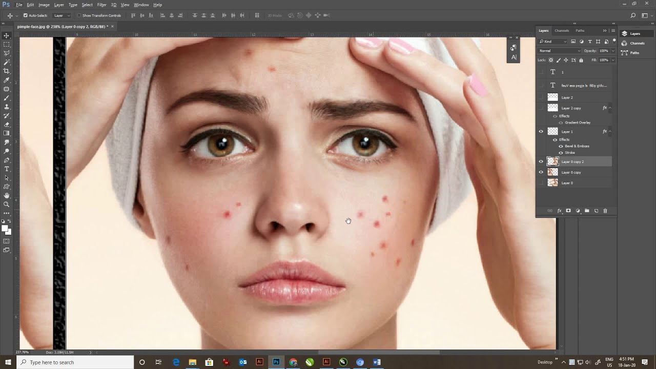 HOW TO REMOVE PIMPLE IN 1 MINUTE IN PHOTOSHOP TUTORIAL YouTube how-to-remove-pimple-in-1-minute-in-photoshop-tutorial-youtube