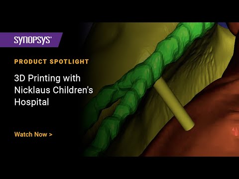 Point of Care 3D Printing with Synopsys Simpleware Software - YouTube