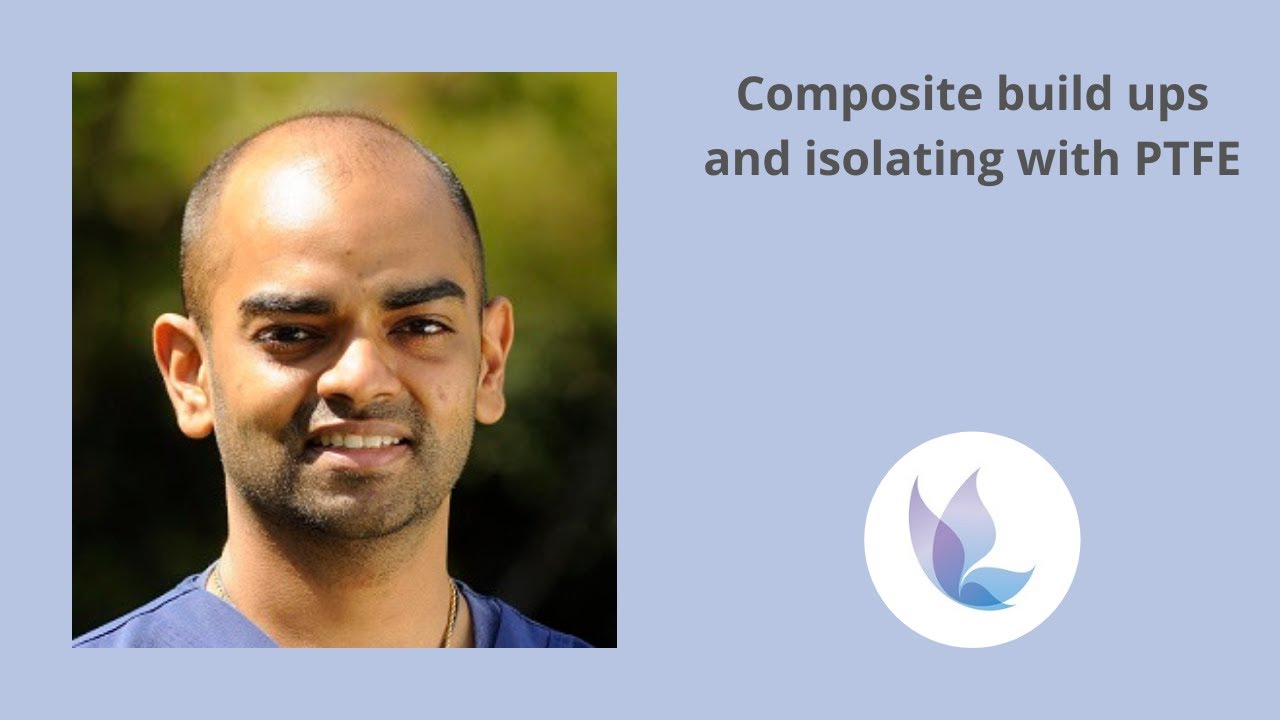 Composite build ups and isolating with PTFE - YouTube