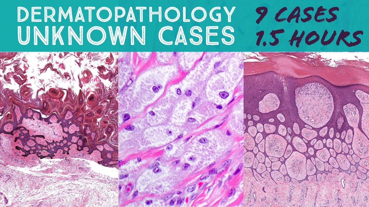 Dermatopathology Unknown Cases (for University of New Mexico UNM ...