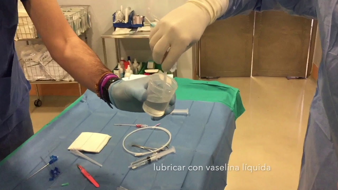 Videoteca SEPD - Técnica de colocacion de PEG mediante pexias gástricas ...