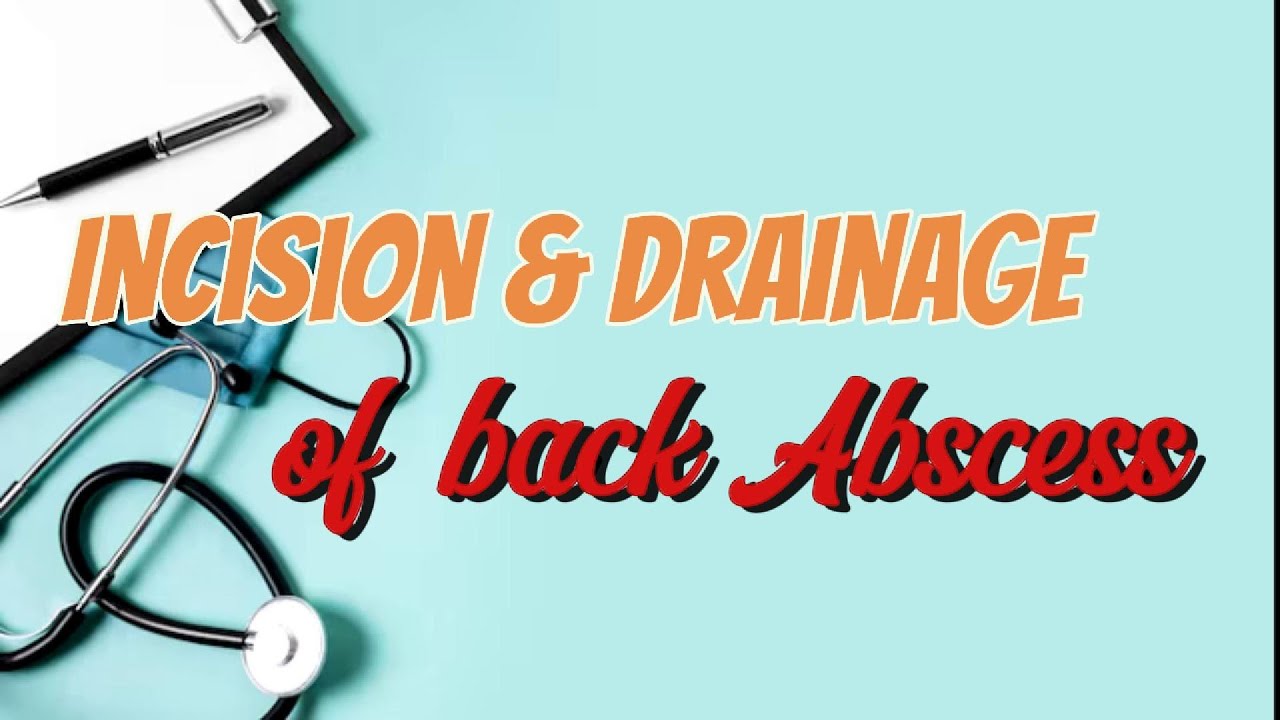 Chunky Monkey | Back abscess Incision and Drainage - YouTube