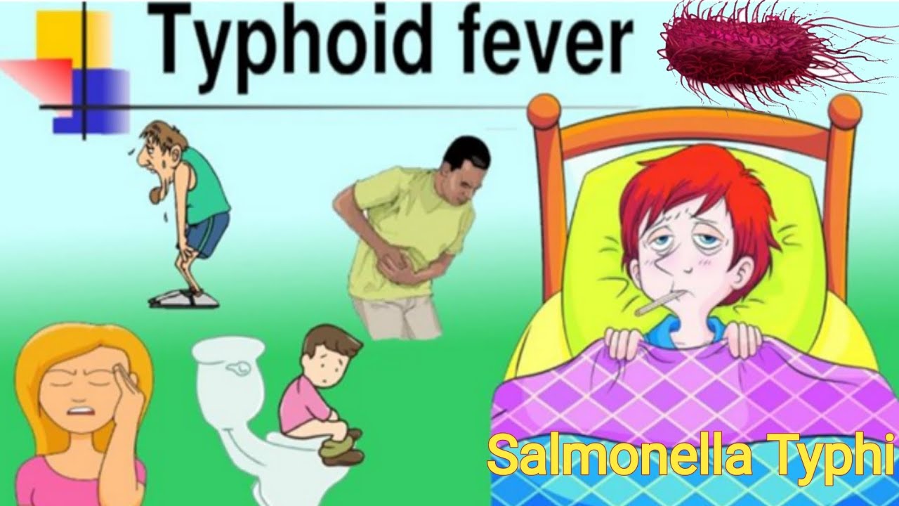 Typhoid Fever symptoms & Treatment | Salmonella Typhi | Typhoid ...