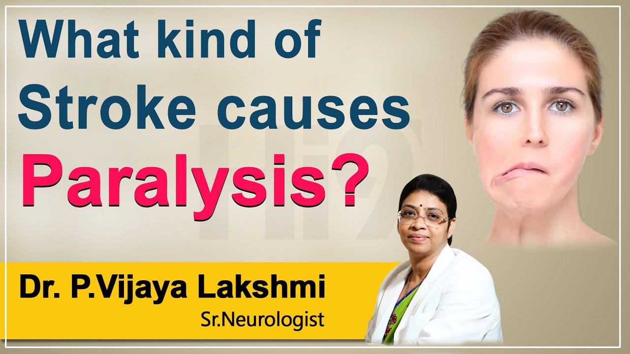 Hi9 | What kind of Stroke Causes Paralysis ? | Dr. P.Vijaya Lakshmi Sr ...